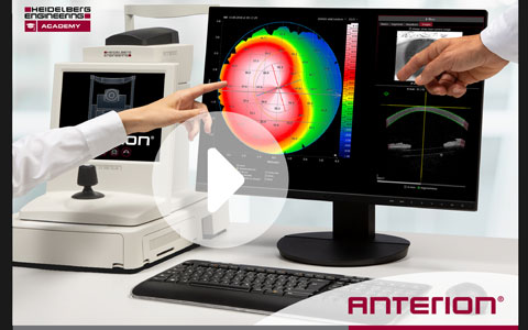 Course: Welcome to your new ANTERION!