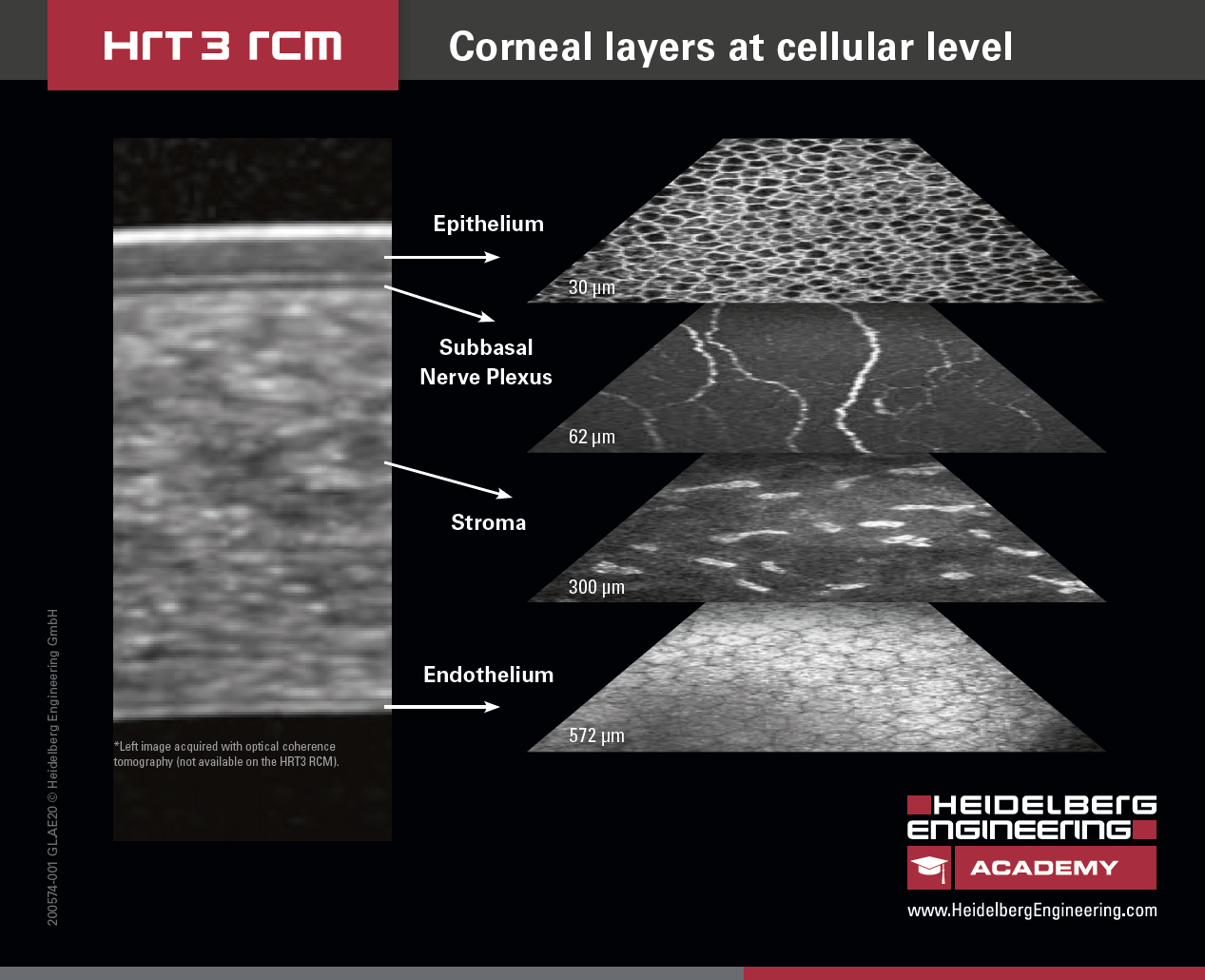 Course: Corneal Layers at Cellular Level | HRT3 RCM