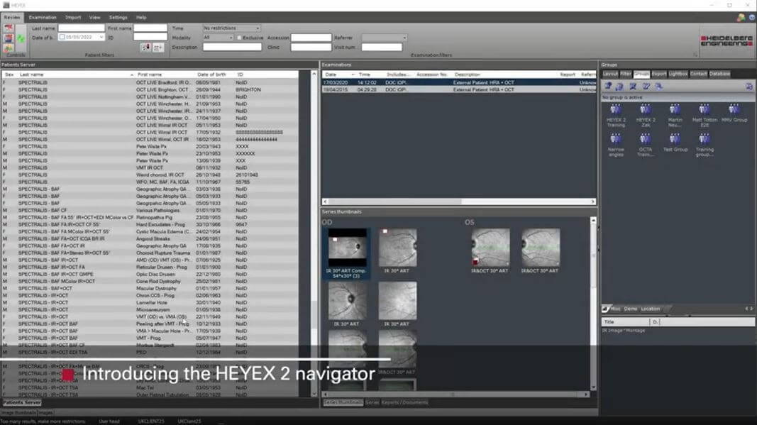 Course: Welcome to Heidelberg Eye Explorer!