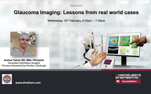He Academy Recorded Webinars Glaucoma Int