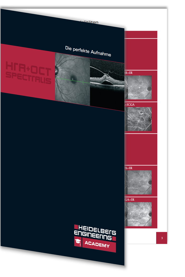 Course: PDF-Tutorials SPECTRALIS – INT