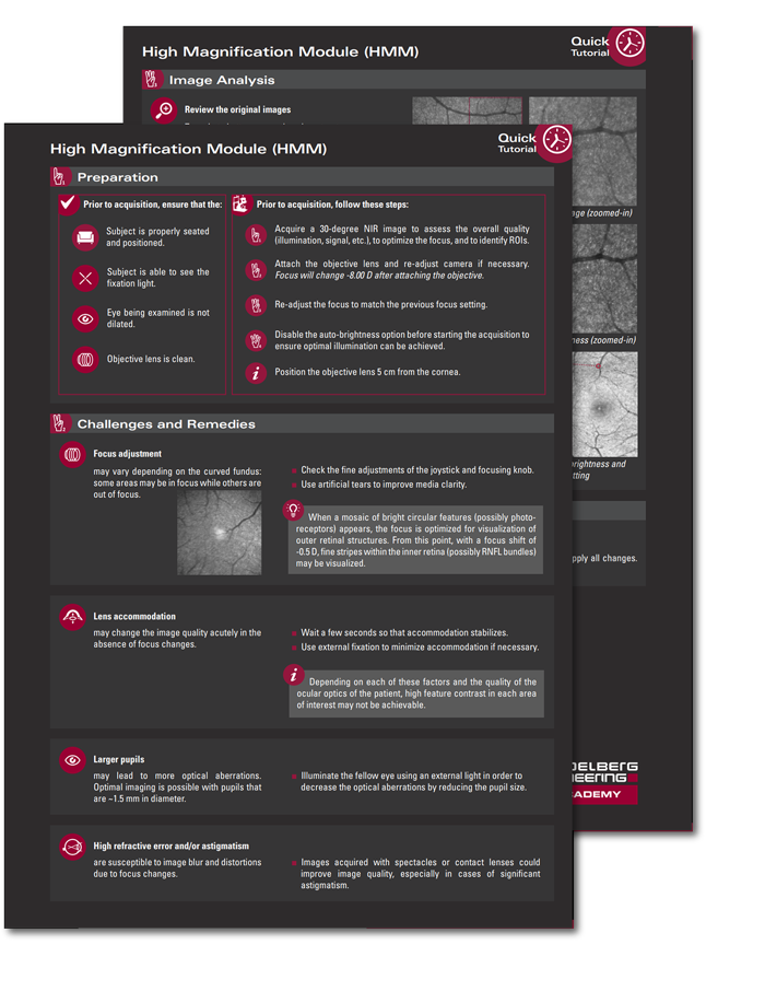 Course: Image Acquisition and Analysis | SPECTRALIS HMM