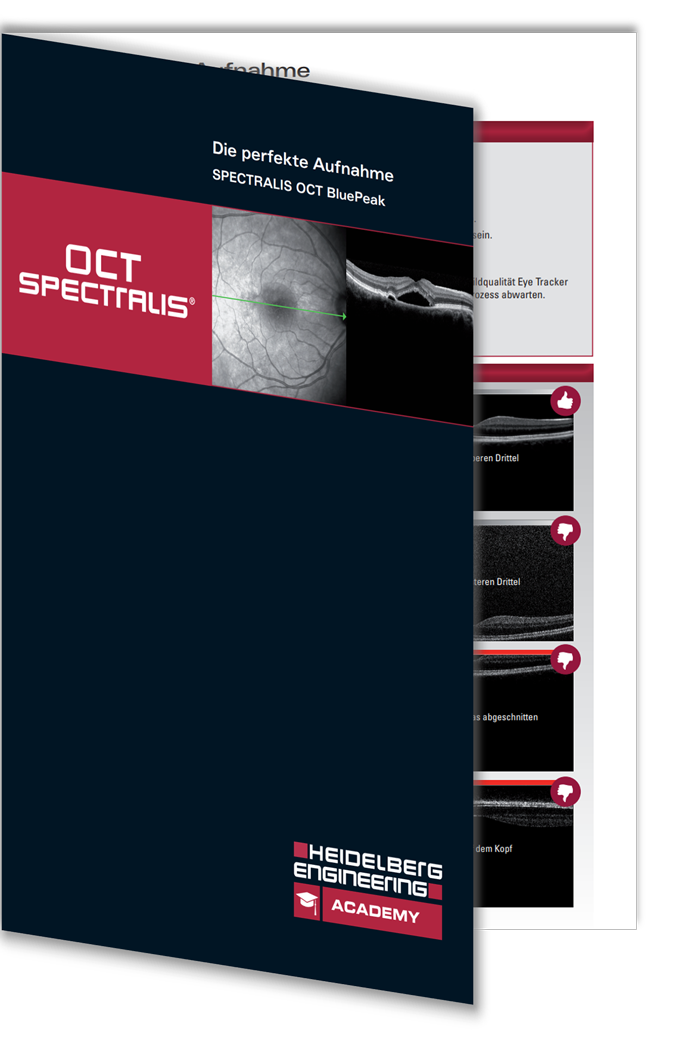 Course: PDF-Tutorials SPECTRALIS – INT
