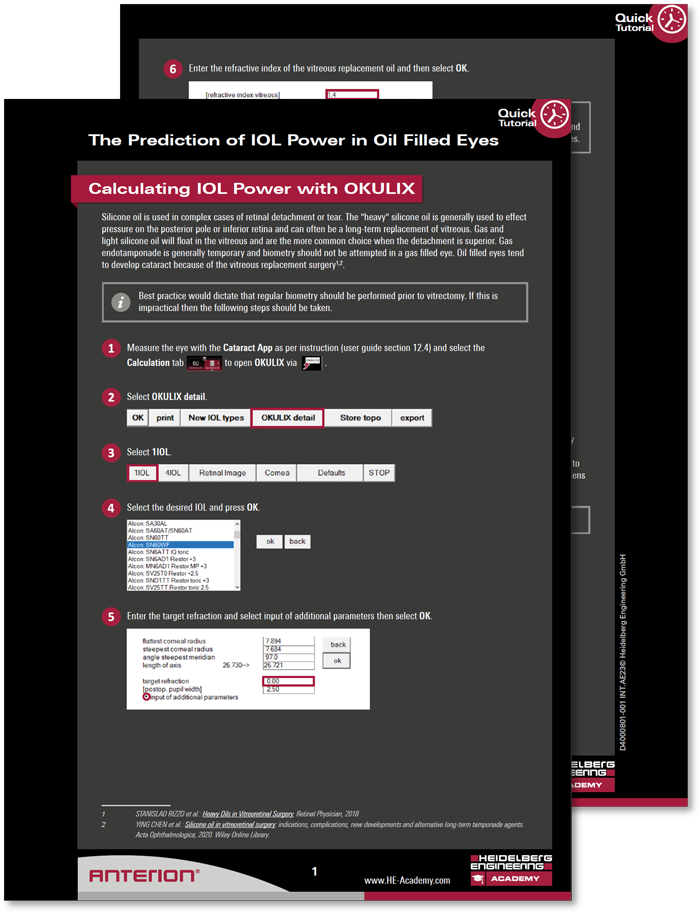 Course: IOL Power Prediction with OKULIX in Oil Filled Eyes