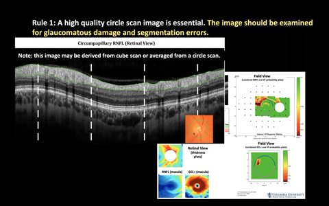 HE Academy: Recorded Webinars - Glaucoma – INT